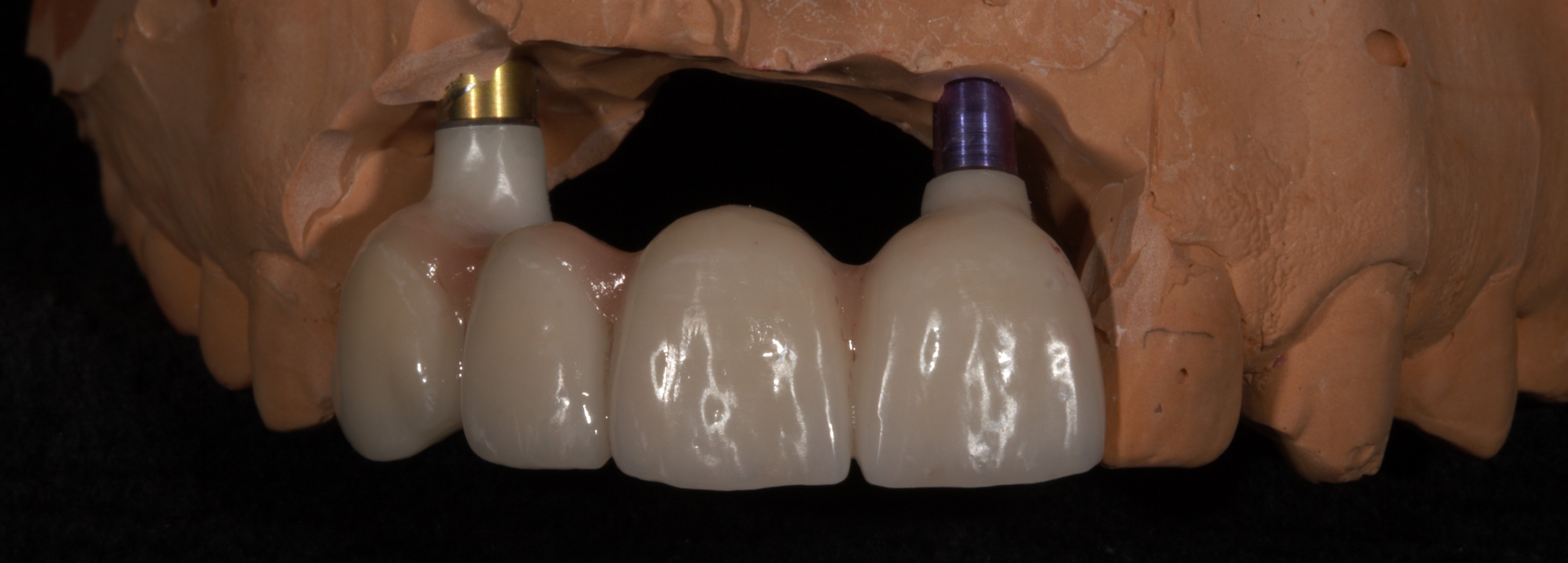 Gallery - Ide Ceramics